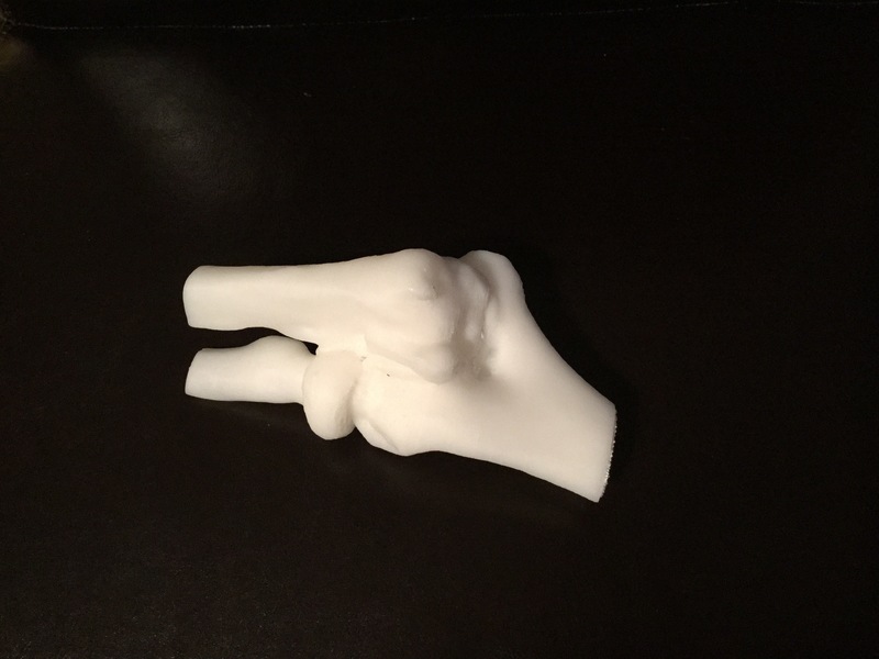 MOI 3D Medical Printing Program - Pinshape