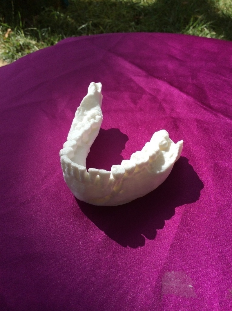 Homo Naledi Skull Reconstruction - Lower Face - Pinshape
