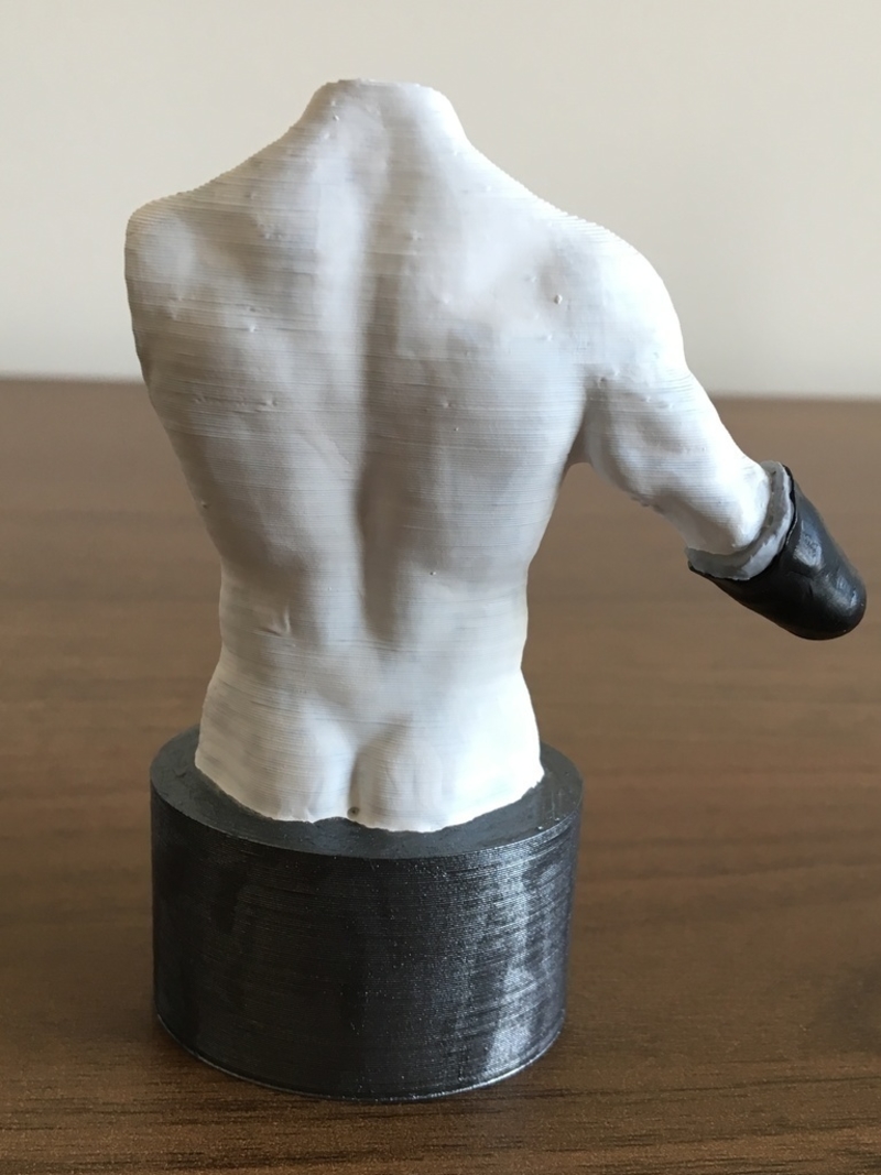 Transradial (below-elbow) limb loss/difference model for prosthe - Pinshape