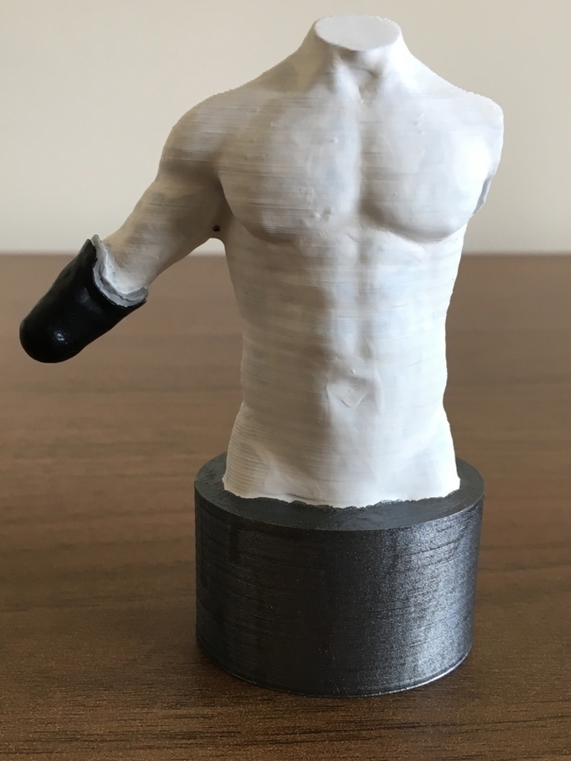 Transradial (below-elbow) limb loss/difference model for prosthe - Pinshape