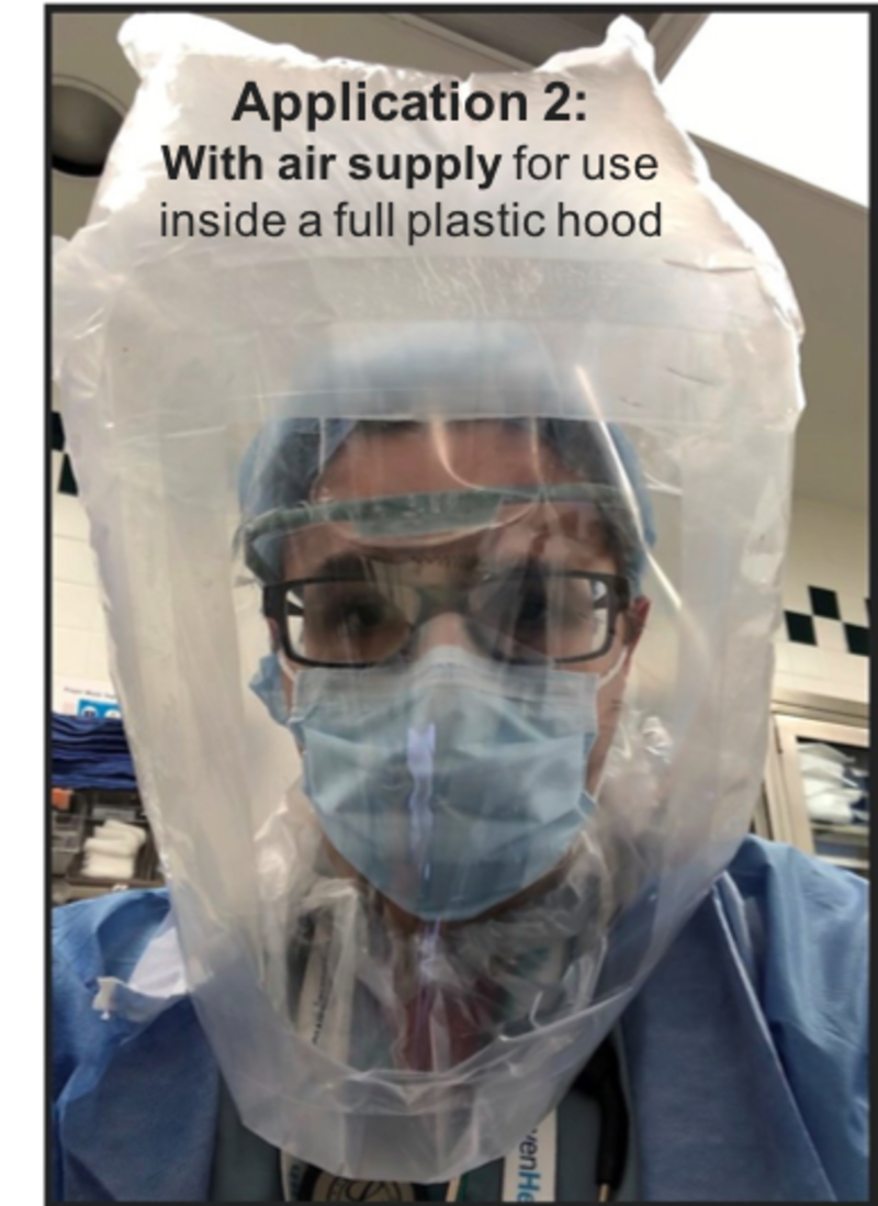 OxyFrame Ventilated Face Mask Frame - Pinshape