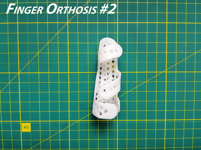 Finger orthosis - Pinshape