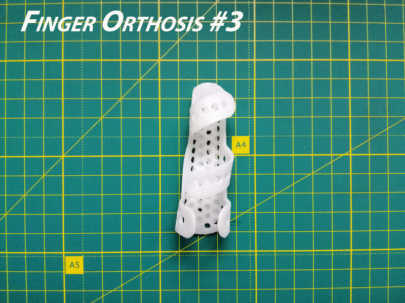 Finger orthosis - Pinshape
