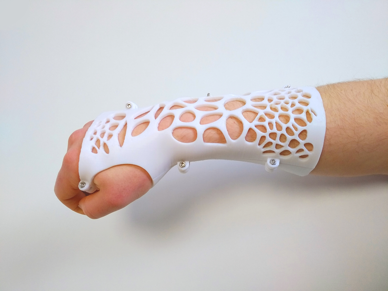 ARM SPLINT - ARM CAST - ARM PLASTER - MEDICAL - Pinshape