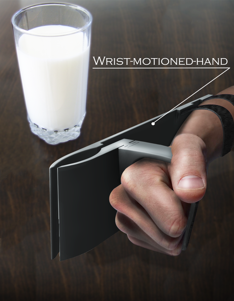 Dupuytren's Versatile Hand Mount - Pinshape